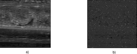 Figure 5 From An Efficient Framework To Detect Cracks In Rail Tracks
