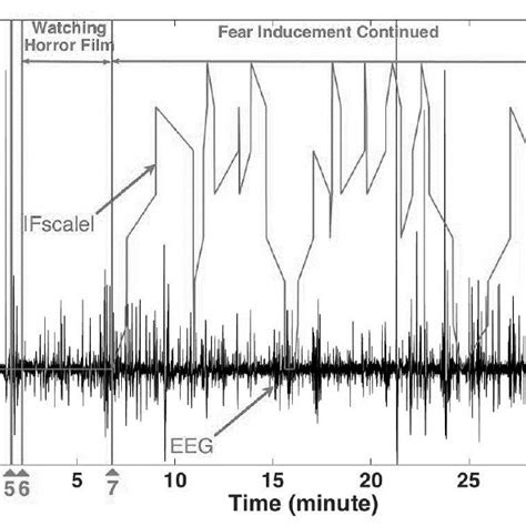 Eeg Frequency Ranges And Its Representation Of The State Of Mind