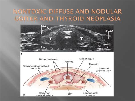 Thyroid Disorders Hussam Alhawari Md Face Ecnu Ppt Download Thyroid Disorders Hussam Alhawari Md Face Ecnu Ppt Download