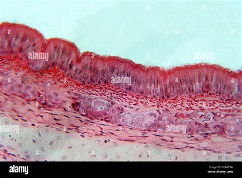 Pseudostratified Columnar Epithelium With Goblet Cells