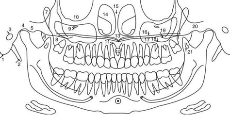 Boards Maxilla And Surrounding Structures Labeling Diagram Quizlet