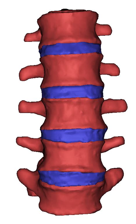 Figure A4 Reference Patient Model Segmentation Used To Realize The Ssm