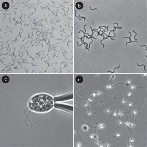 R Detecting Thousands Of Overlapping Organisms Using Latent Space