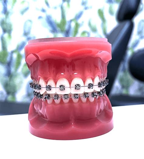 Orthodontist In El Paso Tx Gross Orthodontics El Paso Orthodontics