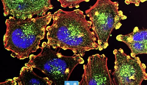 Spatial Transcriptomics Unlocking The Secrets Of Gene Expression