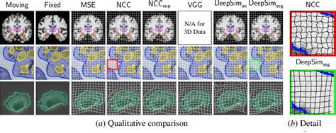 semantic similarity metrics for learned image registration