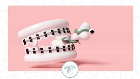 Dent And Go On Linkedin Debunking The Myth Of Tooth Worms