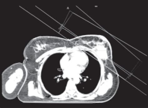 Tangential Field Planning For Nb Download Scientific Diagram