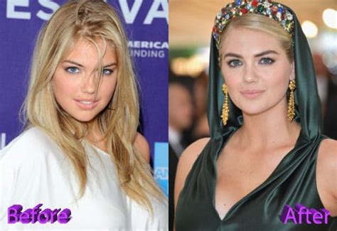 Kate Upton Plastic Surgery The Rumors Are Storming Again