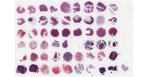 mo541e mouse multiple organ normal tissue array 10 cases 54 cores