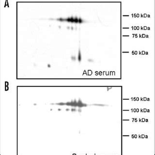2d Analysis Of Serum Ceruloplasmin In Ad A And Controls B The Ph