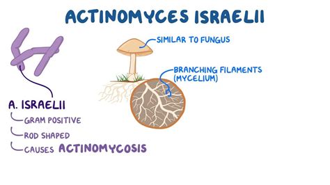 Actinomyces Pyogenes