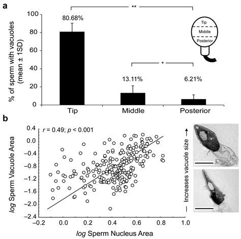 Human Sperm Head Vacuoles Are Related To Nuclear Envelope Invaginations