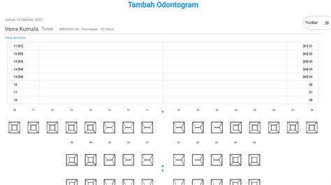 Klinik Gigi Lebih Cepat Isi Rekam Medis Elektronik Pakai Odontogram
