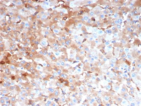 Alpha 2 Macroglobulin Antibody A2m4849 Azide And Bsa Free Nbp3 20833 Novus Biologicals