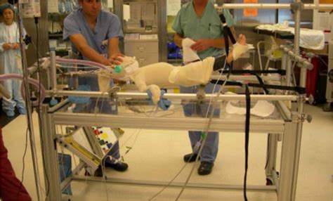 The Evolution Of Edf Casting Journal Of The Pediatric Orthopaedic