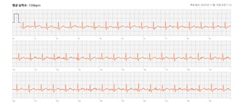 심장박동이 어떤지 알 수 있을까요 궁금할 땐 아하