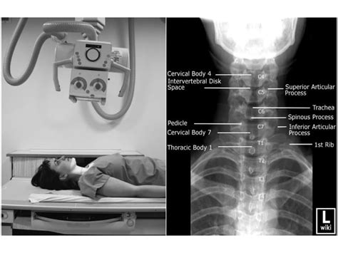 Radiography Positioning Spine Ppt Radiography Positioning Spine Ppt