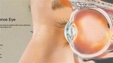 Стартап колишнього очільника Neuralink Ілона Маска навчився повертати втрачений зір Science