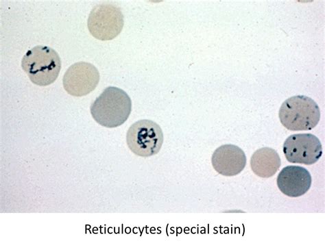 Hematopoietic System Kristine Krafts Md Ppt Video Online Download