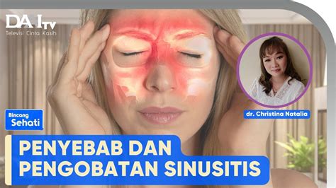 Penyebab Dan Pengobatan Sinusitis Bincang Sehati Youtube