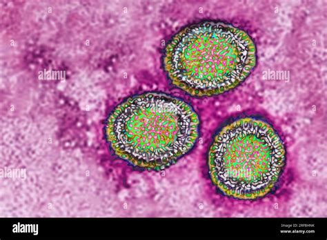Influenza Virus Flu Under Microscope Micropedia Under The Lens Of A