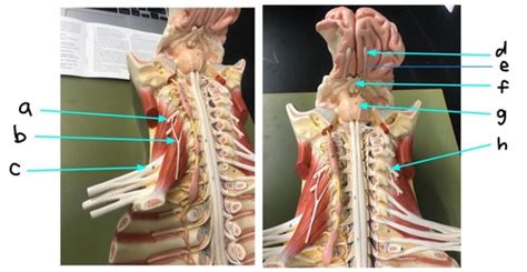 Exam Nerve Plexus Flashcards Quizlet