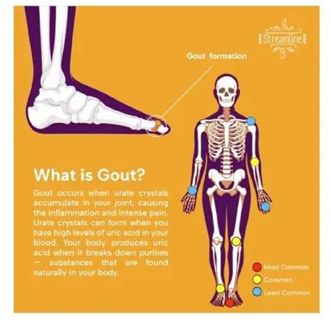 Joint Arthritis Capsule Packaging Size 30 Capsules At ₹ 315bottle In