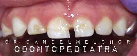 Odontopediatra Culiacan La Dr Jesús Daniel Melchor Soto