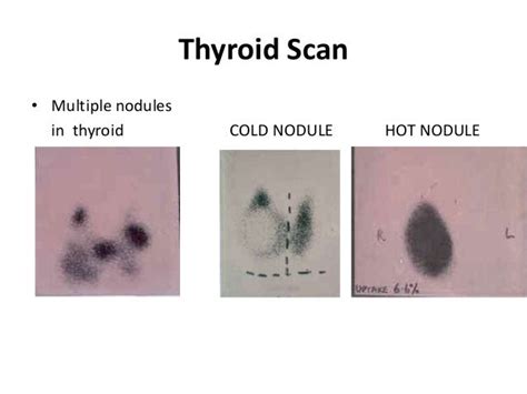 Scans Dr Padmesh
