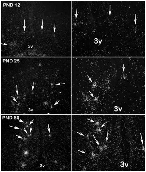 Sex Differences In The Effect Of Prepubertal Galp Infusion On Growth
