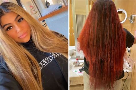 Balding Man Goes On Month Long Sex Ban For Hair Growth And Totally