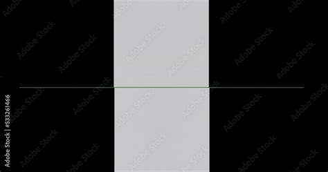 Femoral Angiogram Of Femoral Artery Showing Femoral Artery Vessel