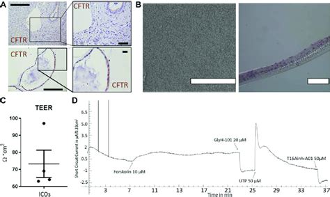 Intrahepatic Cholangiocyte Organoids Icos Have Functional