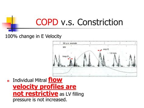 Ppt Restriction And Constriction Powerpoint Presentation Free