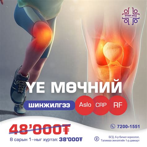 ҮЕ МӨЧНИЙ ӨВЧНИЙ шинж тэмдэг Өнөрмед Лаборатори