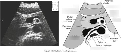 Figure 10 08 A Transverse Scanning Plane Section Of The Abdominal