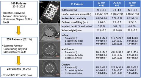 Computed Tomography Geometry Of Extremely Undersized Sapien 3