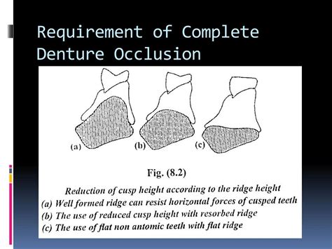 Ppt Principles Of Occlusion In Complete Denture Powerpoint