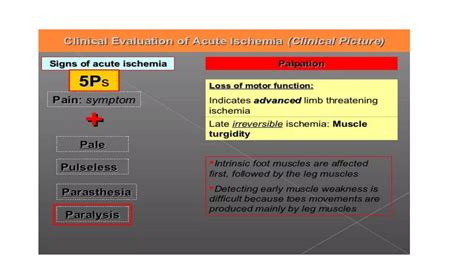 Acute Limb Ischemia Pptx