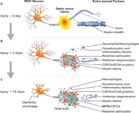 Neural Regeneration Research