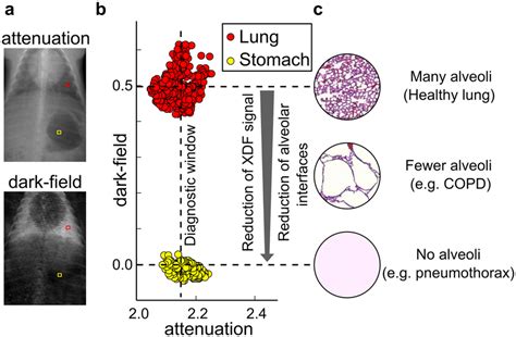Potential Of XDF Imaging A Two Regions Of Interest With Similar