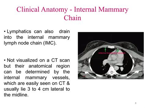 Regional Lymph Node Management In Breast Cancer Pptx