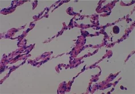 Novus Biologicals™ Human Lung Tissue Microarray Normal Human Lung