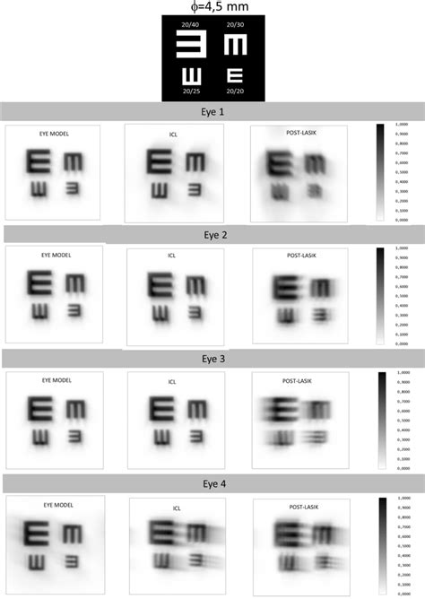 Simulated Vision Of The Optotypes Of The Three Eye Models Eye Model