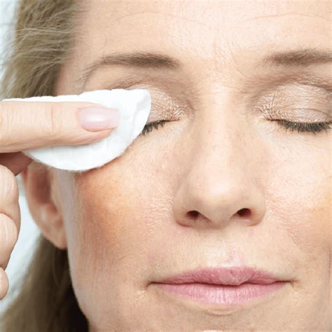 What Are The Symptoms Of Blepharitis Thea Shop