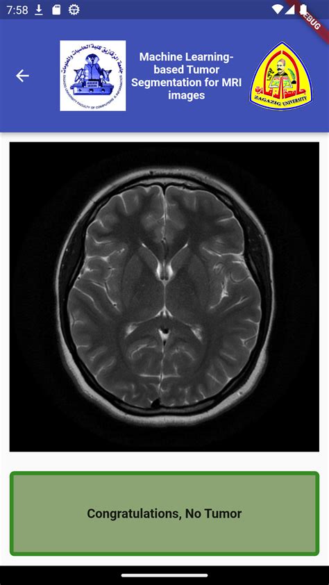 GitHub S448 Tumor Segmentation My Graduation Project Application For Detecting Brain Tumor