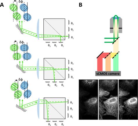 Machine Learning Assisted Interferometric Structured Illumination Microscopy For Dynamic