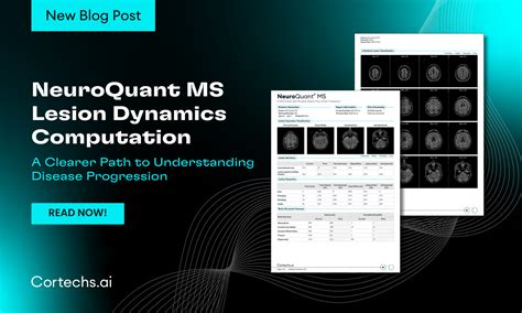 Neuroquant 40 Tba Report Updates Cortechsai