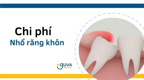 Chi Phí Nhổ Răng Khôn Và Các Yếu Tố ảnh Hưởng đến Chi Phí Nhổ Răng Khôn
